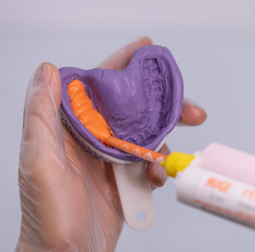 Type 3 Heavy Body (Auto-mix/Fast-Set), 遠東精密科技股份有限公司